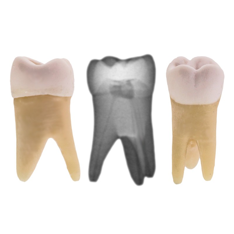 Primeiro Molar Superior 4 Canais :: LikeReal